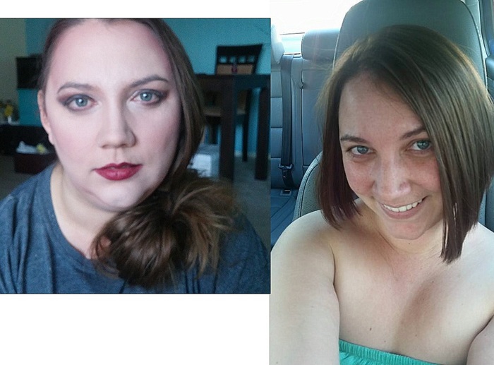 Hypothyroid in photos-Before and After - Stop The Thyroid Madness